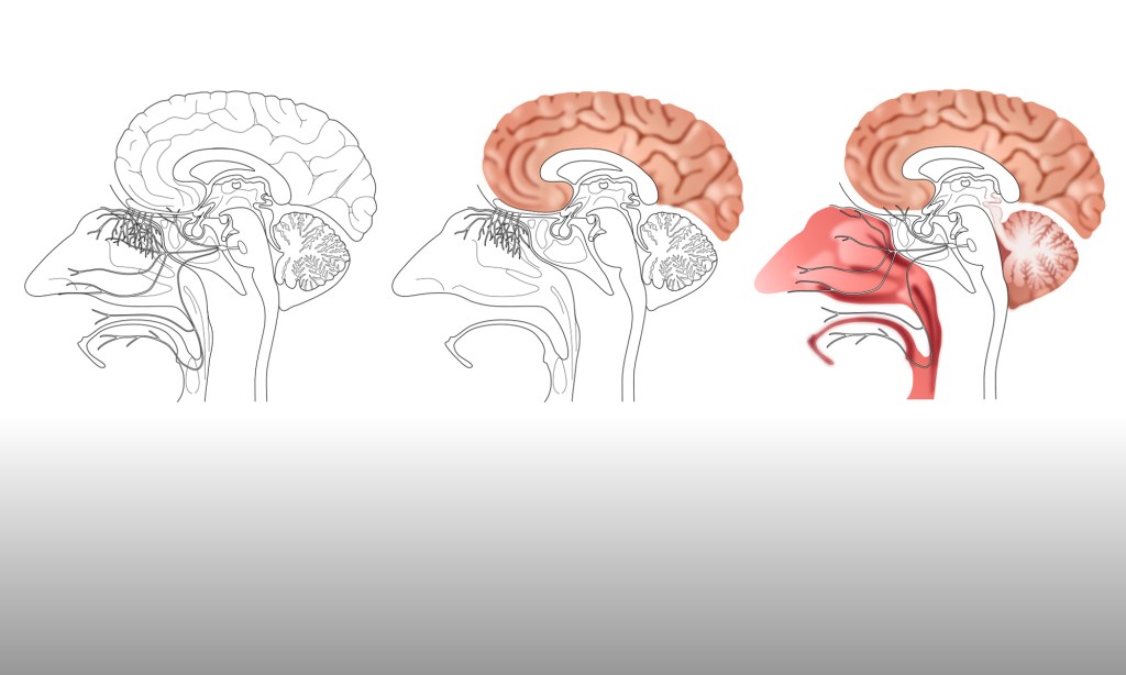 Neuroscience & graphic design – A collaboration between neuroscientists ...